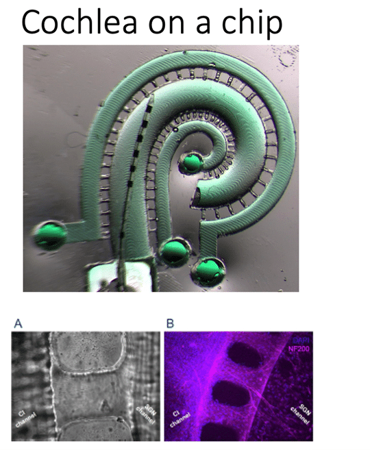 Can we improve what people hear through cochlear implants? - The Evelyn ...