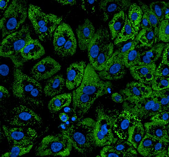 Can stem cell research shed light on liver disease? - The Evelyn Trust